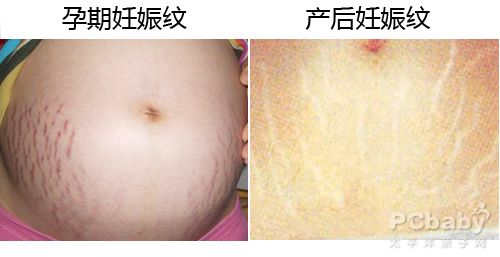 孕妇的乳房左边颜色深就是怀的男孩右边深就是女孩吗有科学依据吗百度宝宝知道 孕妇怀男孩的左边乳房比右边乳房大吗？